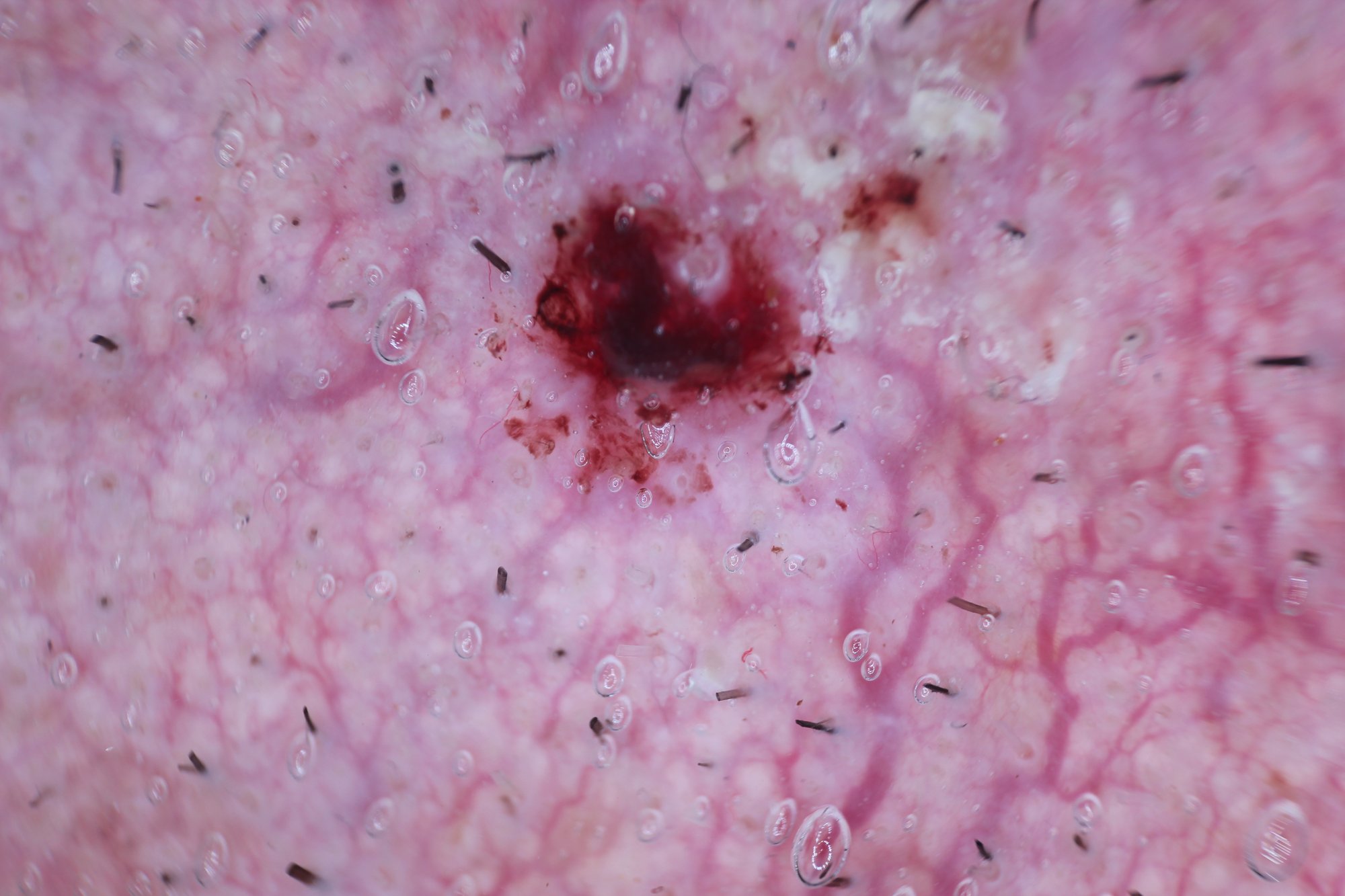 How would you diagnose these three ulcerated lesions?