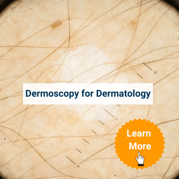 Get Access to free Skin Cancer Online Course