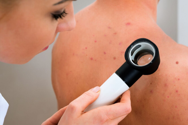 Professional Diploma of General Dermatology